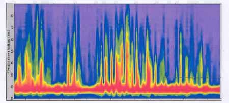 Acoustic backscatter profiling sensors (ABS) - Coastal Wiki